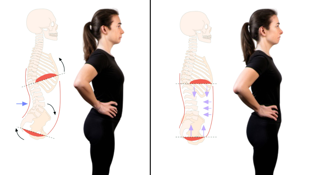 How to Fix Anterior Pelvic Tilt - Mobility Suite - Mobility Suite